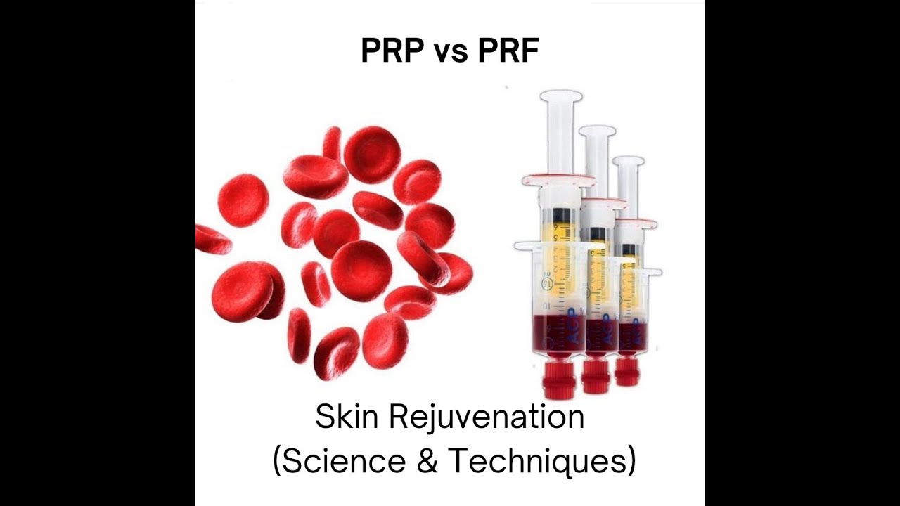 PRP/PRF in Skin Rejuvenation - YouTube