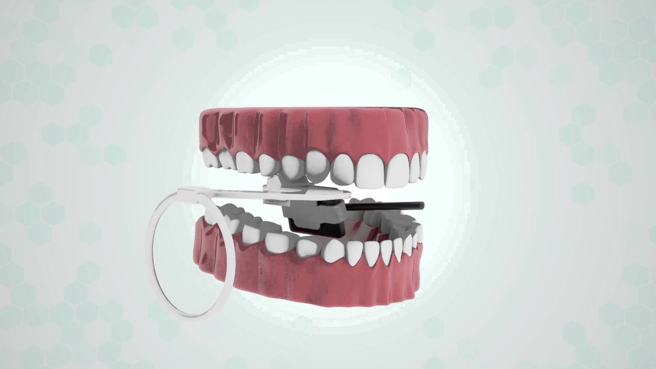 Cone Indicator Digital - YouTube