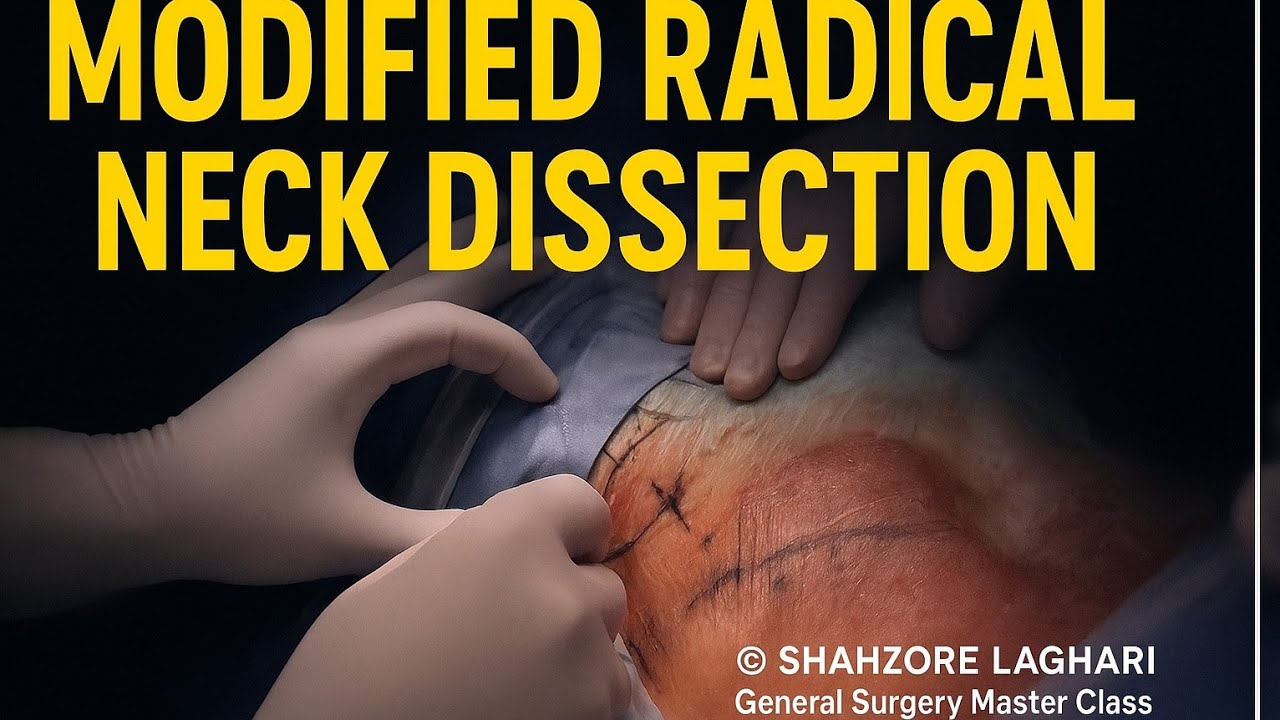 Modified Radical Neck Disection | Metastatic Papillary Thyroid Cancer ...