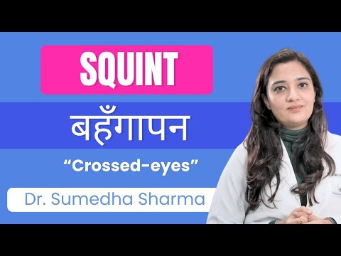 CROSS-EYED? Squint/ Strabismus | बहँगापन/ तिरछी आँखें