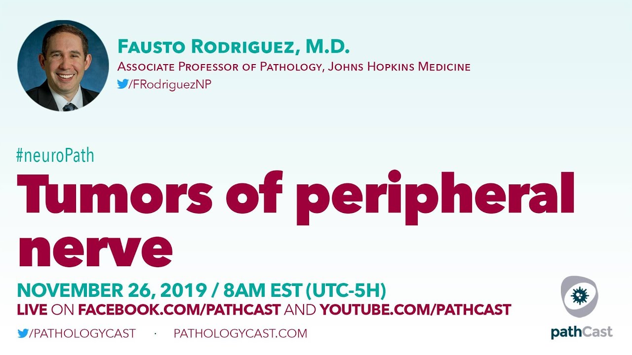 Tumors of peripheral nerve - Dr. Rodriguez (Hopkins) #NEUROPATH - YouTube