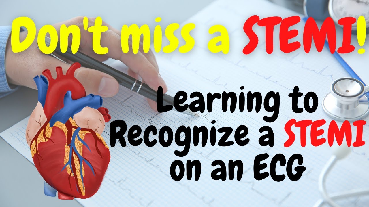 Recognizing a STEMI on an ECG : Emergency Nursing Tips for New Grads ...