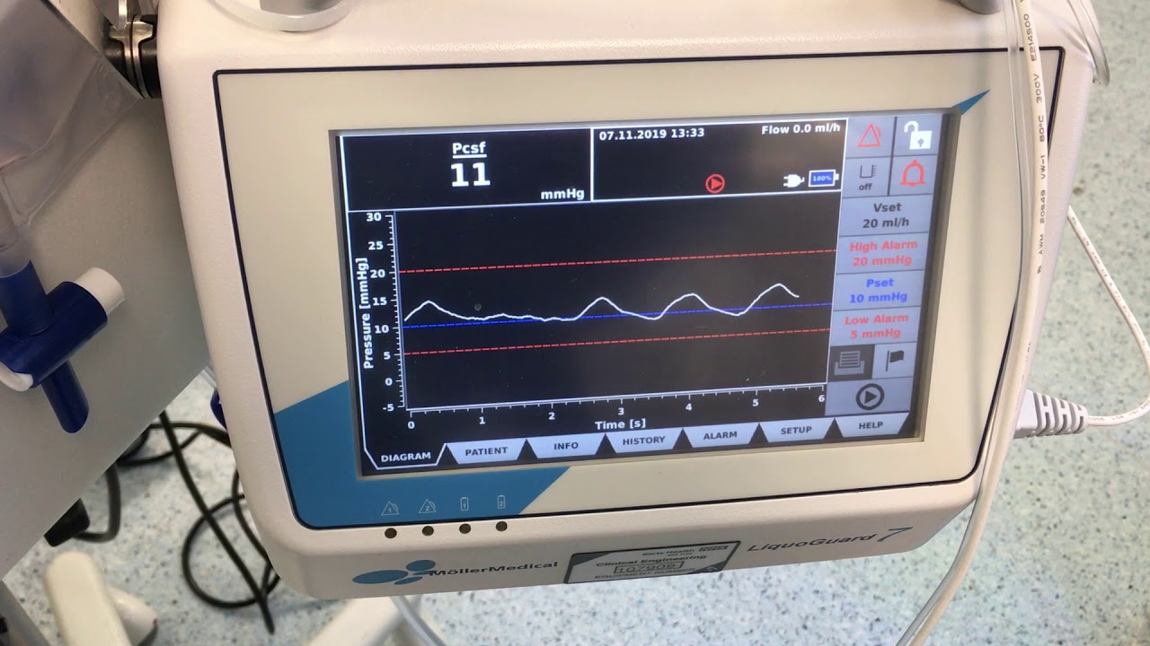 Liquoguard waveform ondulation - YouTube