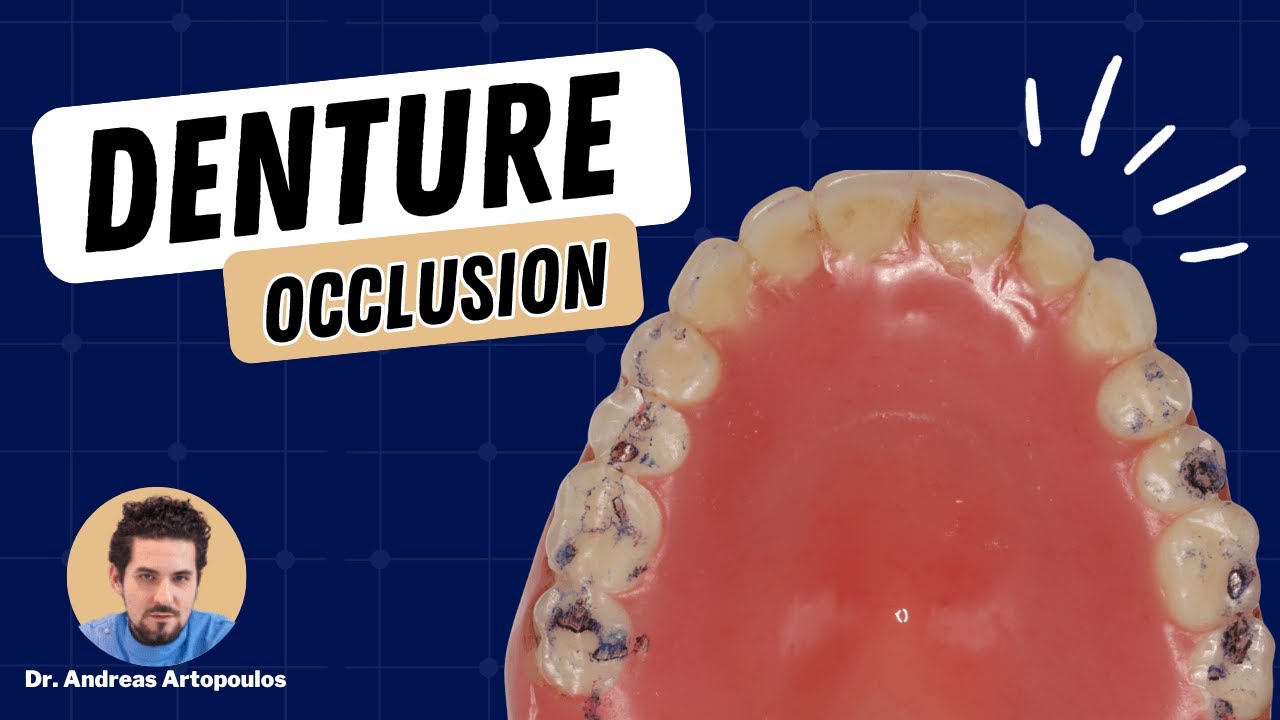 Occlusion for Complete Dentures - PDP162 - YouTube