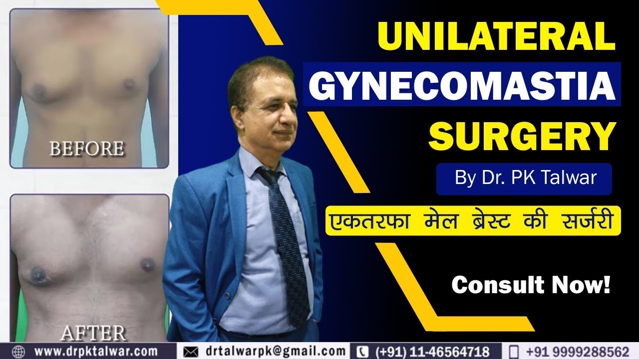 Unilateral Gynecomastia Surgery, Male Breast On One Side Surgery and ...