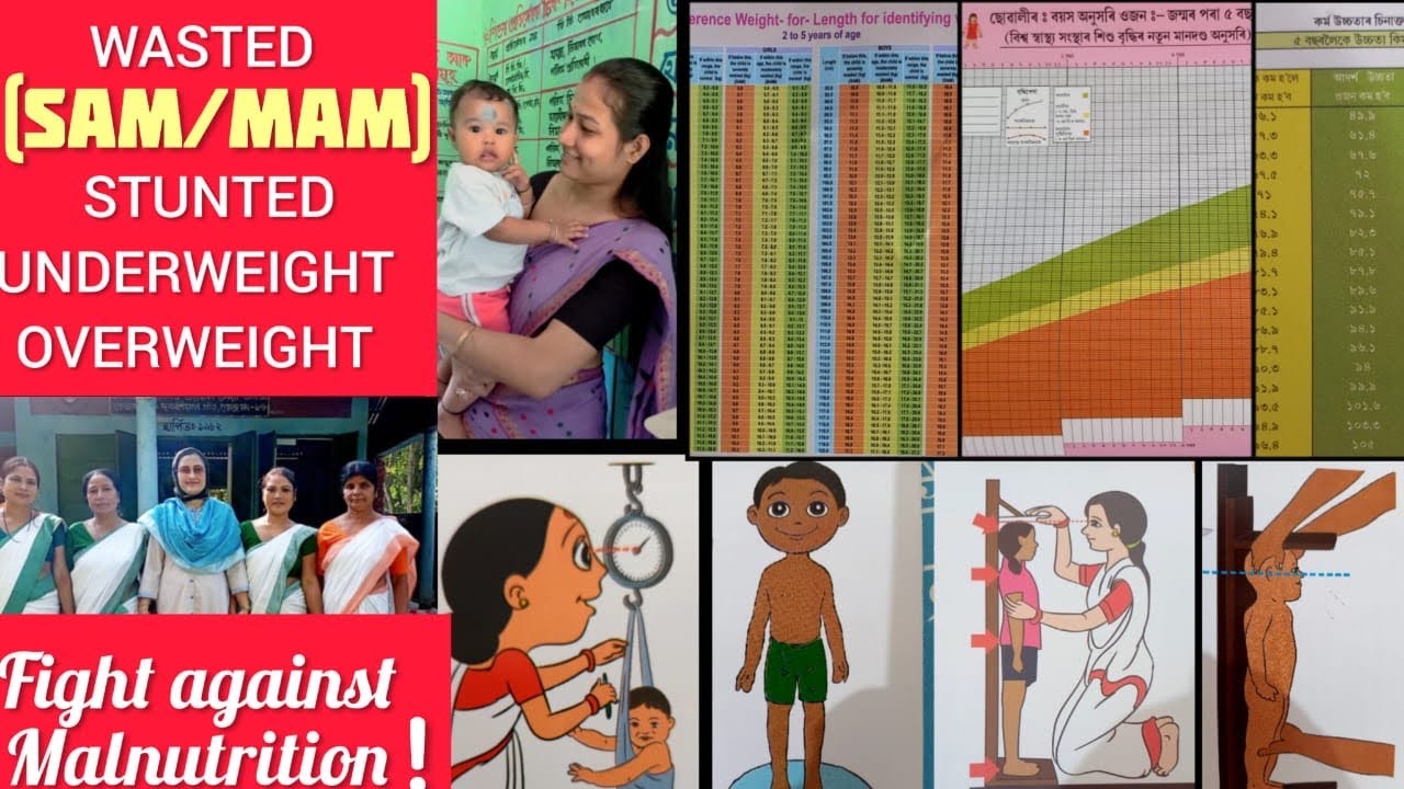 How to identify Wasted (SAM/ MAM)/ Stunted /Underweight children ...