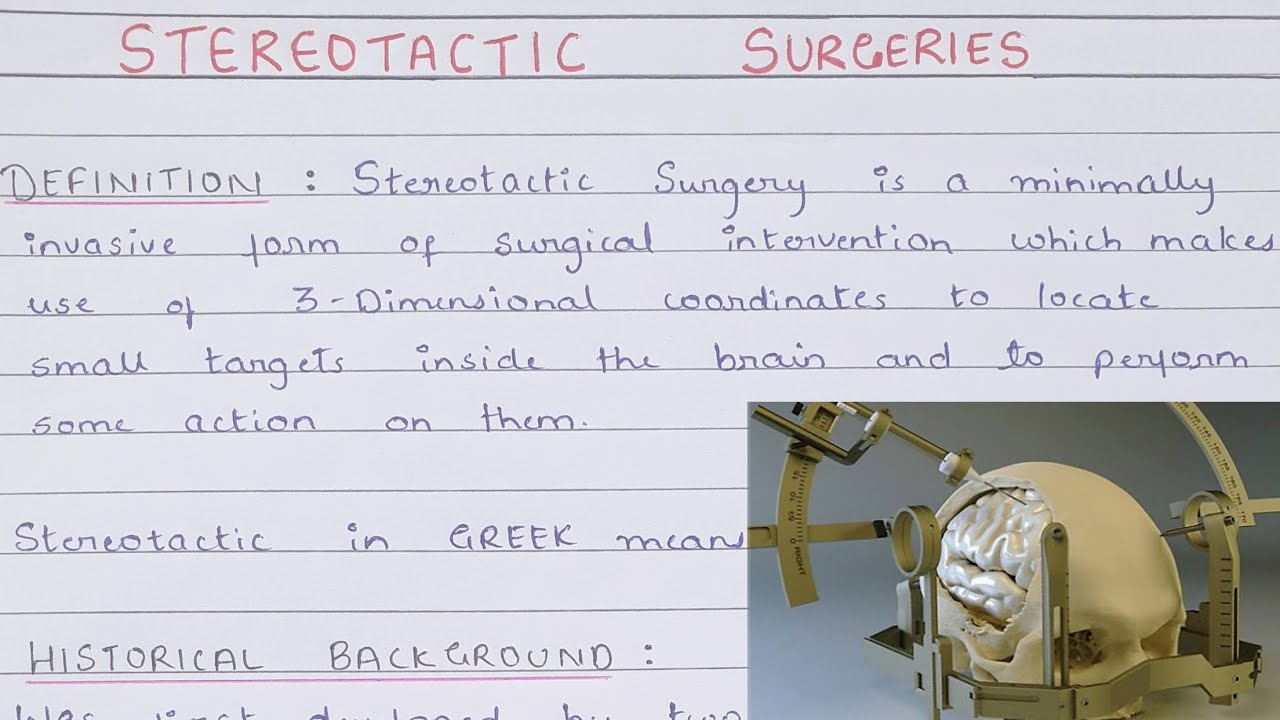 Stereotactic Surgery | Neurosurgery Notes | Types | Advantage ...