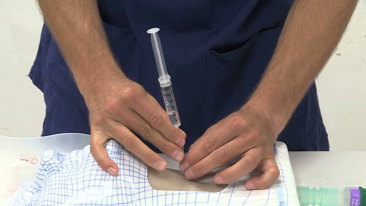 01 Cannula Insertion - YouTube