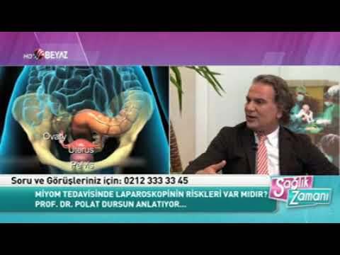 laparoskopik miyomektomi kimlere yapılır kimlere yapılmaz ? Miyom tedavisi Ankara