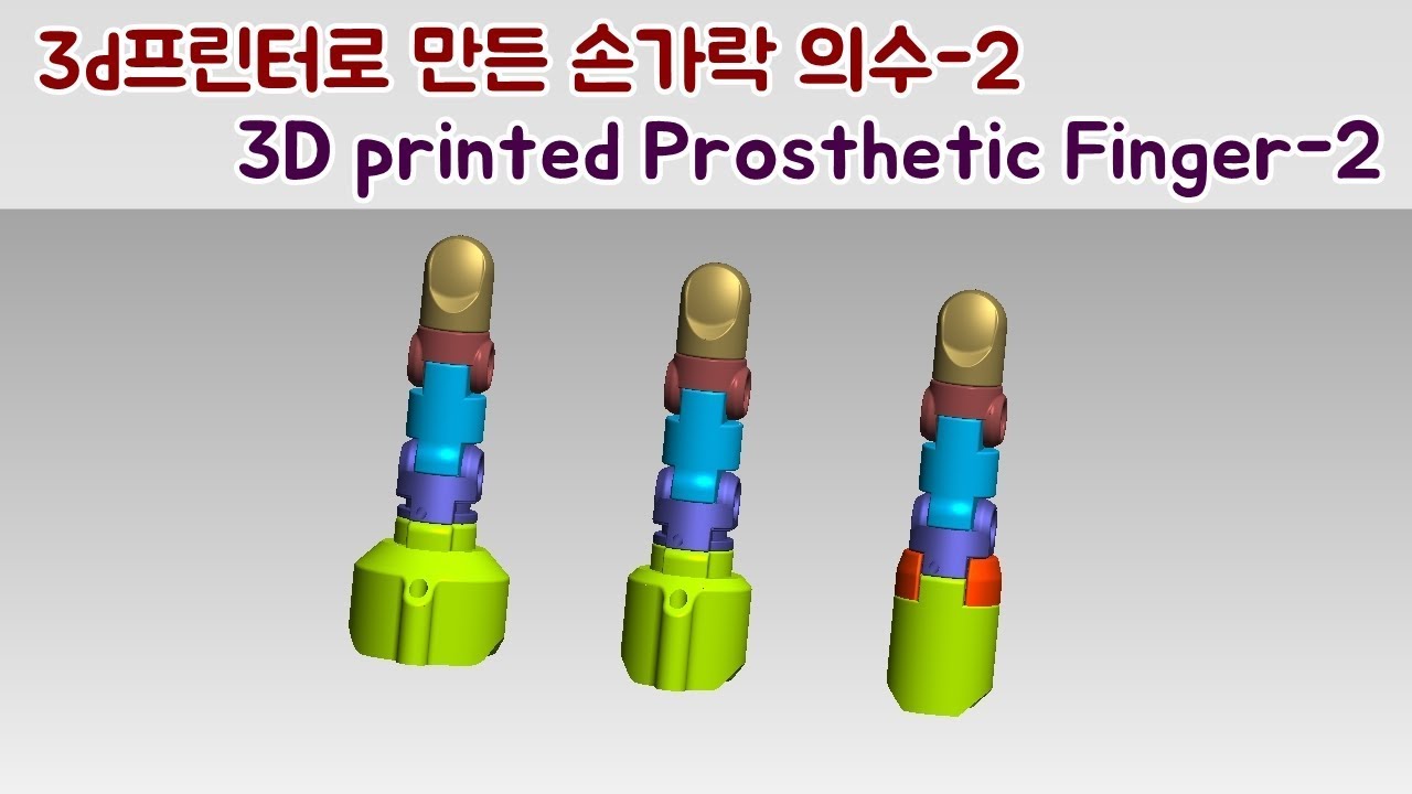 3d프린터를 활용한 손가락 의수-2 / 3d printed prosthetic finger-2 - YouTube