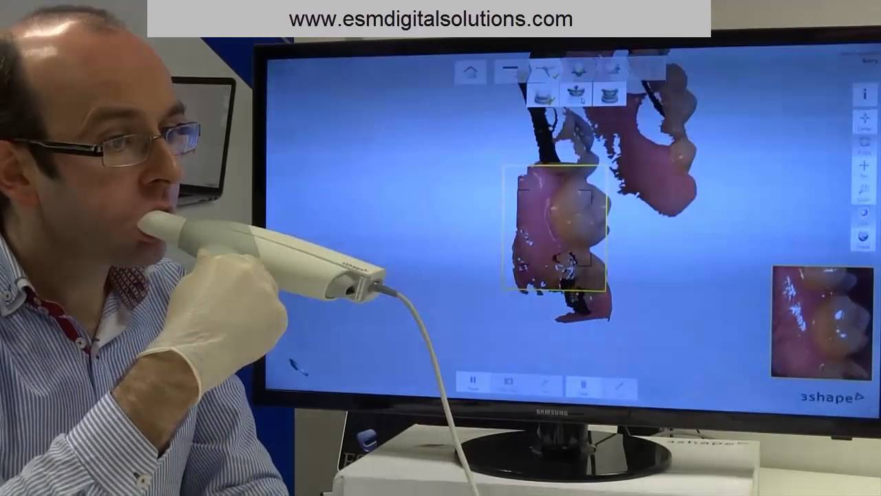 TRIOS Full Arch Scanning Strategy Demonstrated - YouTube