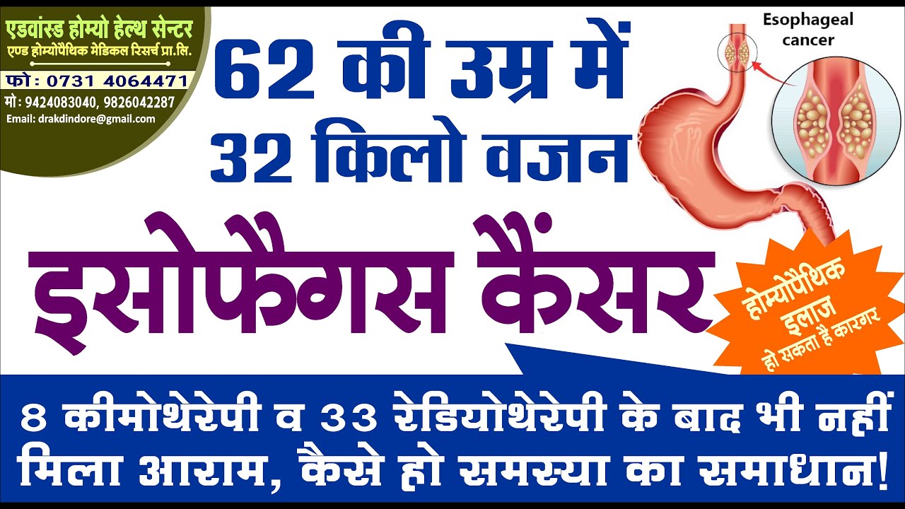 Cancer esophagus food pipe Homeopathy chemo radiotherapy Dr AK Dwivedi ...