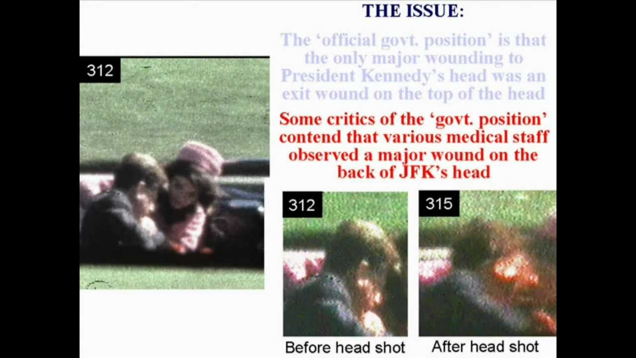 Witness to JFK Head Wound Part VI How Did They Do It? - YouTube