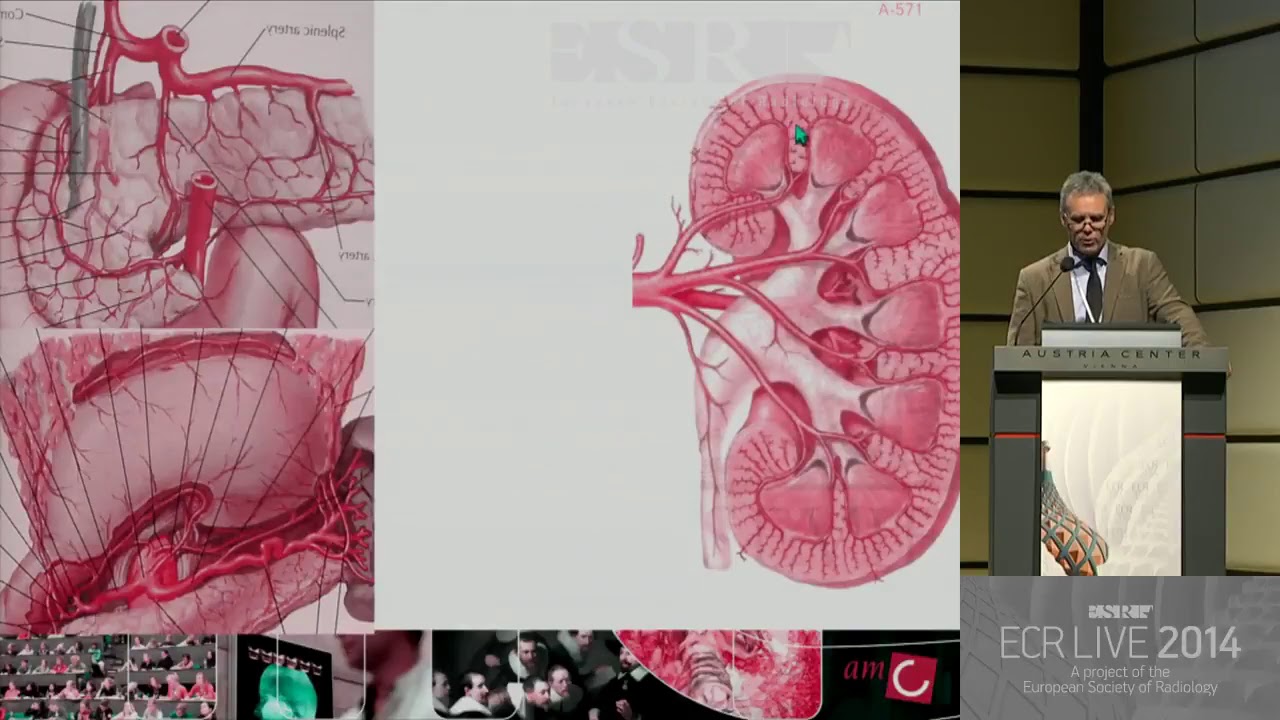 Essentials of Transcatheter Embolization - HD [Basic Radiology] - YouTube