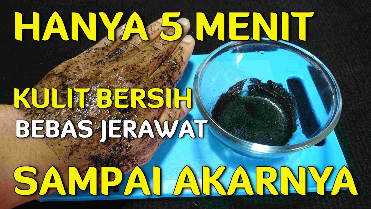 Cara Sembuhkan Jerawat Sampai ke Akar akarnya Hanya 5 Menit..! - YouTube