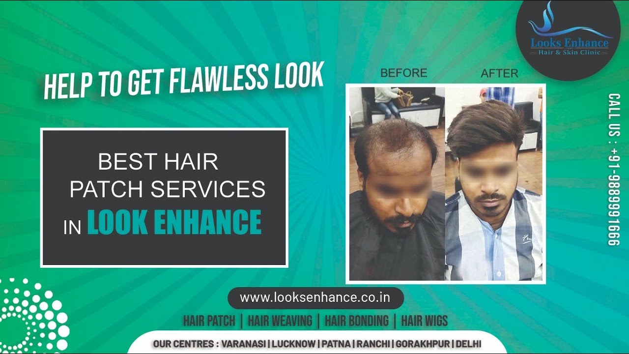 Looks Enhance Hair Patch | Looks Enhance Hair Weaving | Looks Enhance ...
