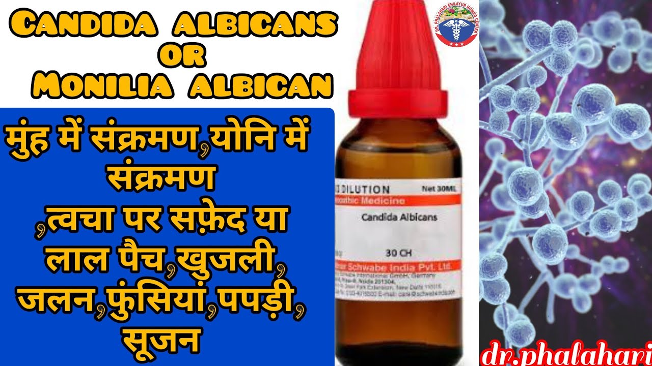 candidiasis causes symptoms and treatment|candida albicans treatment ...