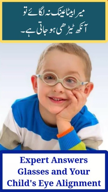 ّWithout Surgery Squint Treatment In Children | Bhengapan ka ilaj - YouTube