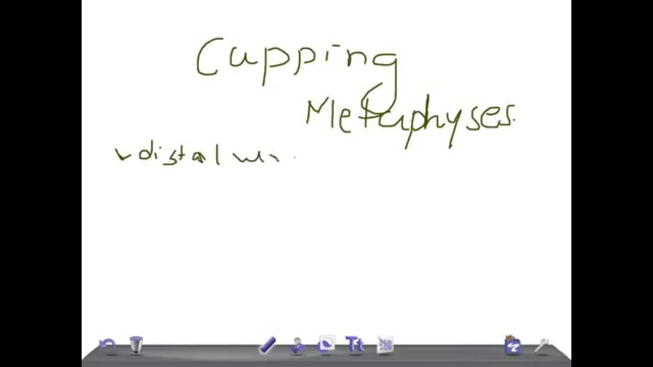 QUICK RADIOLOGY: Cupping of Metaphysis - YouTube