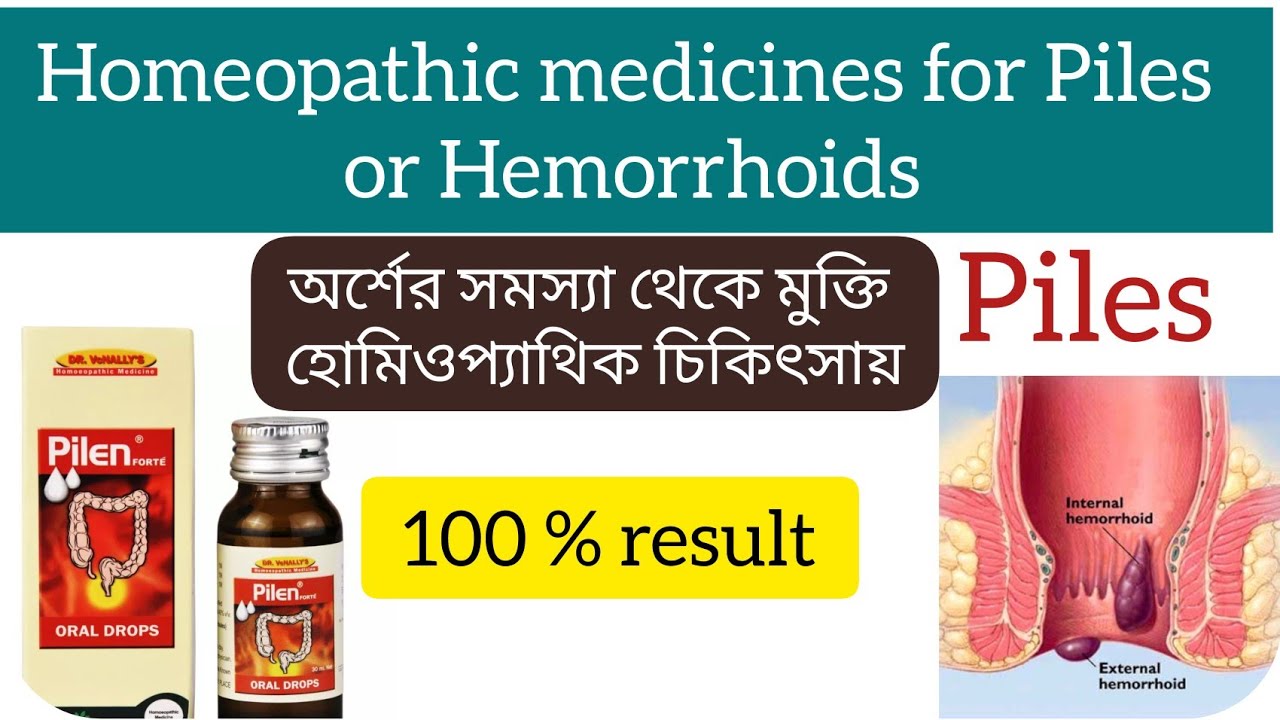 অর্শ বা পাইলসের হোমিওপ্যাথিক চিকিৎসা |Homeopathic medicines for Piles ...