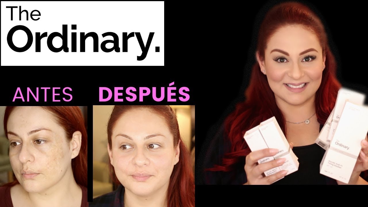 Mis Resultados con THE ORDINARY * Piel Sin Manchas 😍Productos ...
