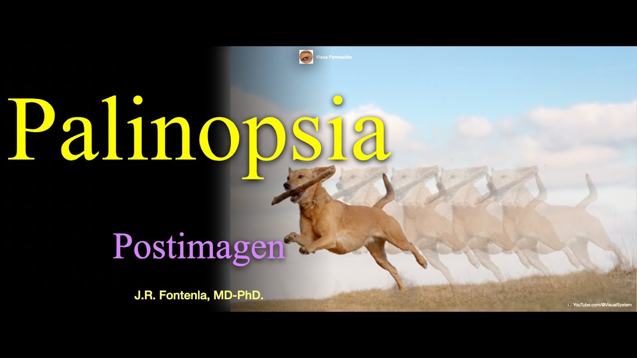 Palinopsia. Postimagen. - YouTube