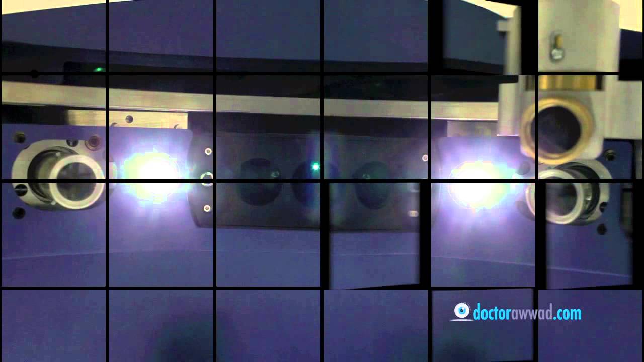 PRK & TransPRK Preoperative and Postoperative Instructions - YouTube