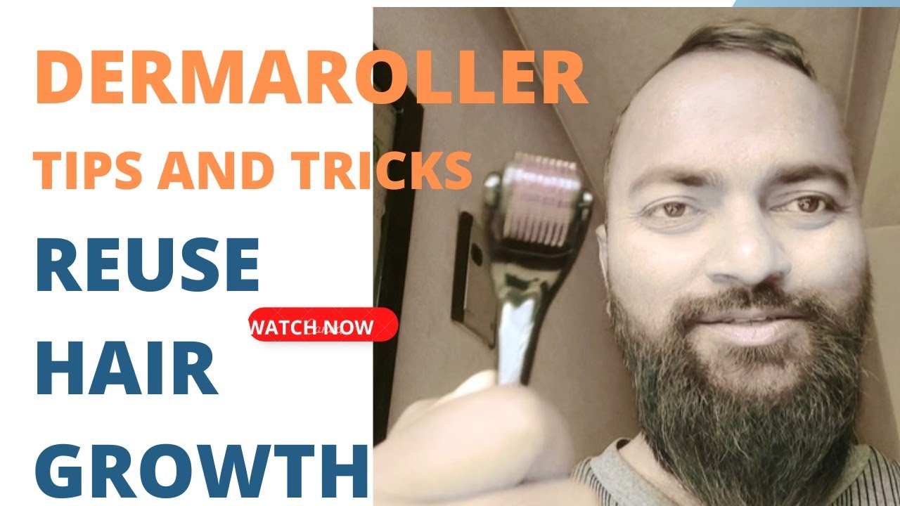 How to use derma roller | reuse derma roller | hair problems - YouTube