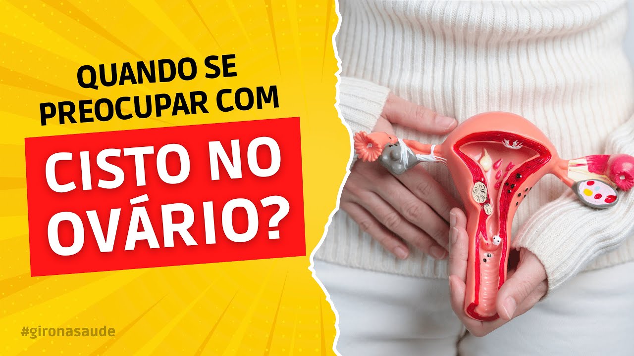 Cisto no Ovário - Causas, Sintomas e Tratamento - YouTube