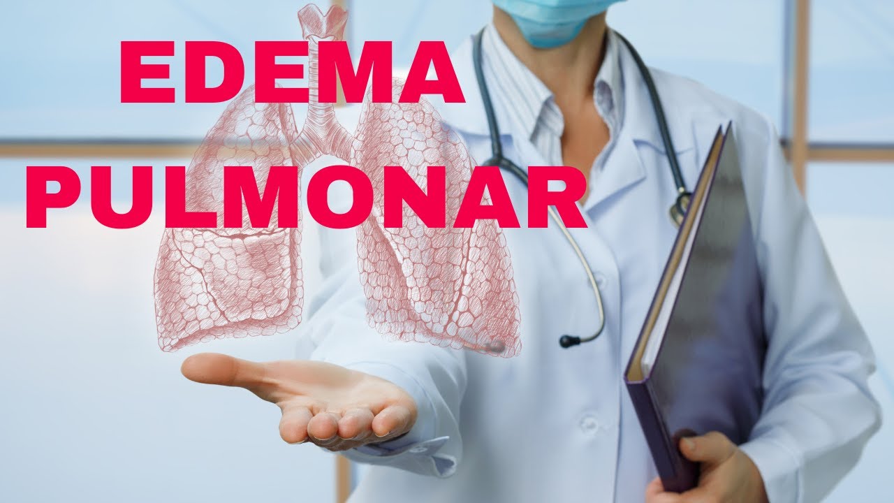 Saiba Como a Insuficiencia Cardiaca e Edema Pulmonar Ocorrem. - YouTube
