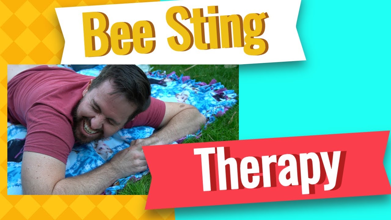 Bee Sting Therapy - Apitherapy On My Back - YouTube