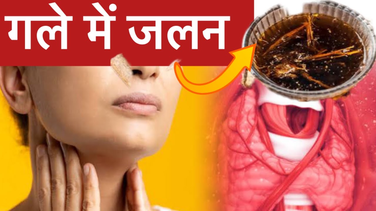 गले में जलन को मिनटो में दूर करने का रामबाण उपाय | Burning Throat ...