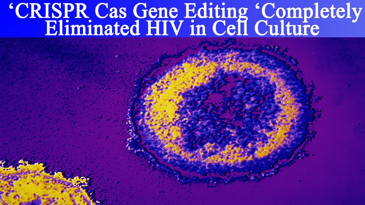 CRISPR Cas Gene Editing ‘Completely’ Eliminated HIV in Cell Culture ...