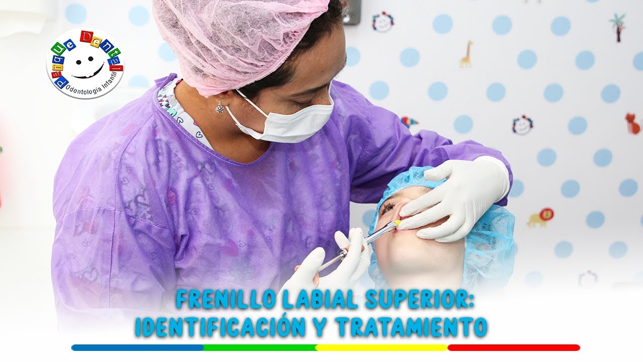 Frenillo labial superior: identificación y tratamiento - YouTube