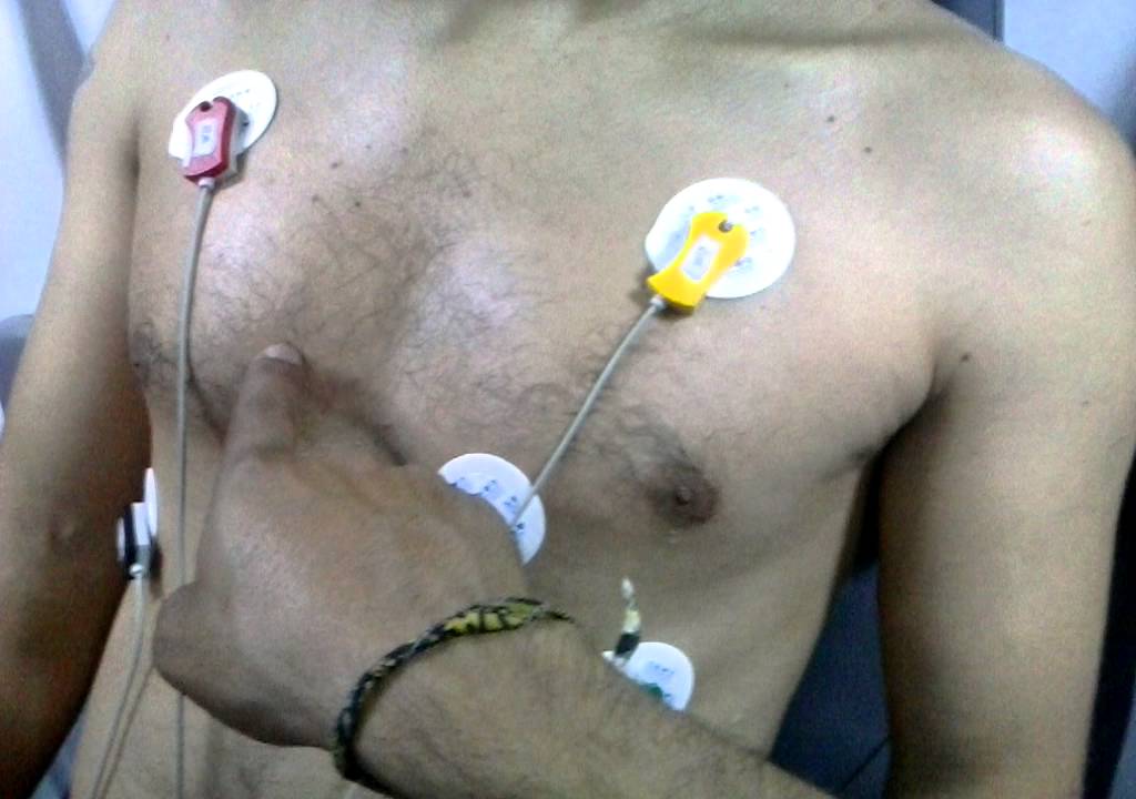 #TAPH Monitorizacion - YouTube