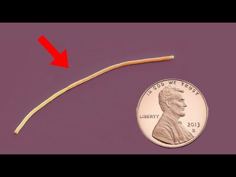 The world's LARGEST Microorganism - YouTube