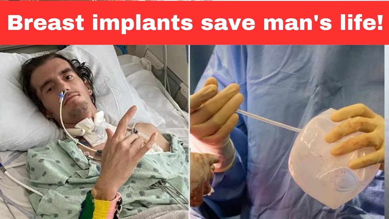 Unbelievable: How Breast Implants Saved a Man's Life - YouTube