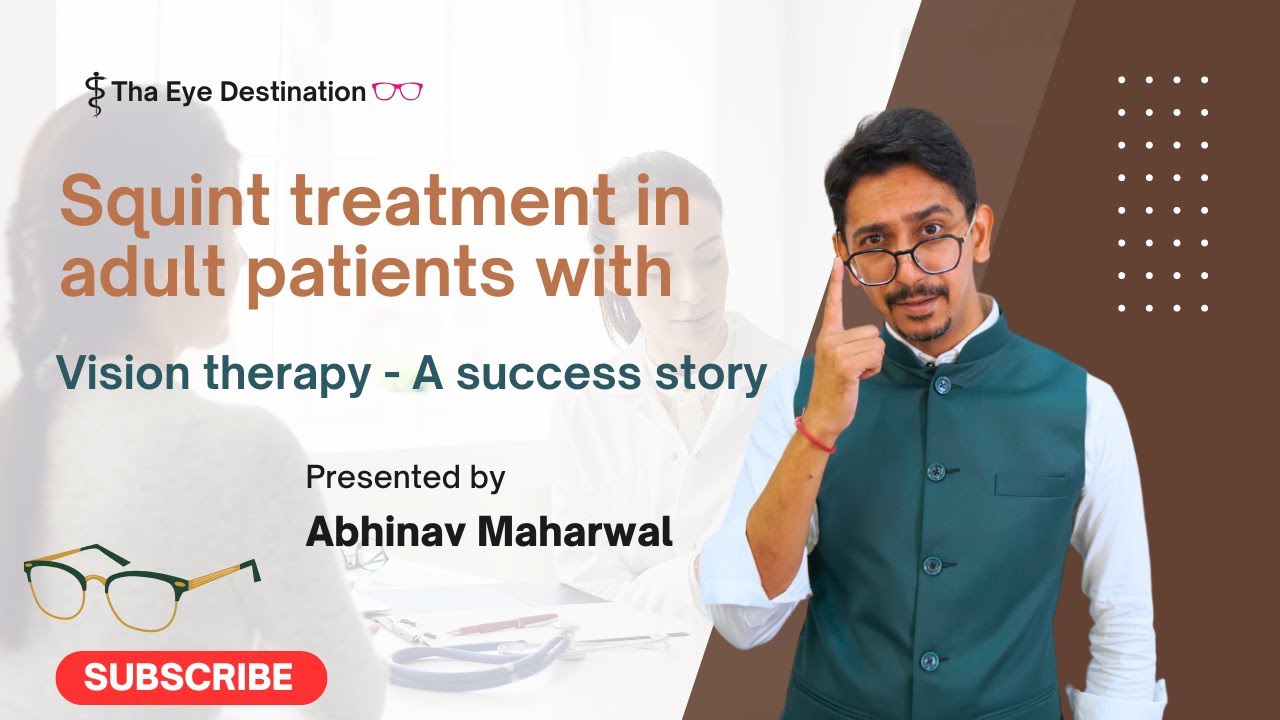 Squint treatment in adult patients with Vision therapy - A success ...