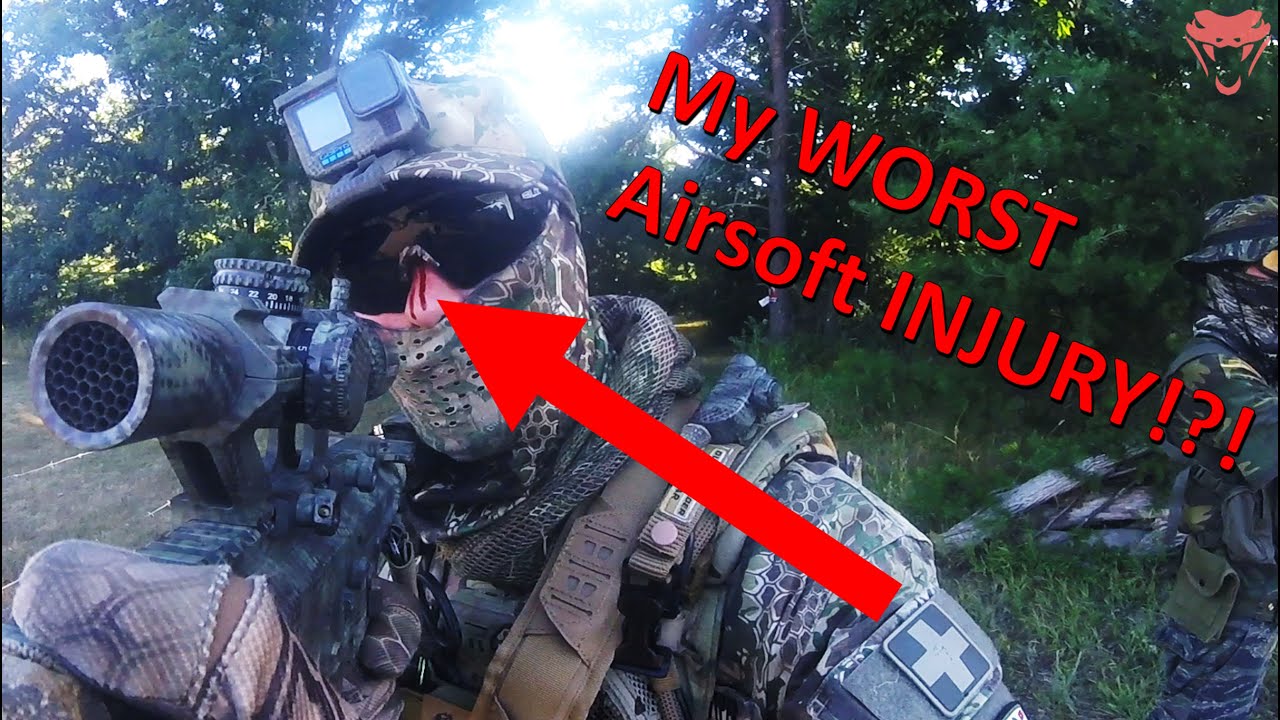 My WORST Airsoft INJURY!?! - YouTube