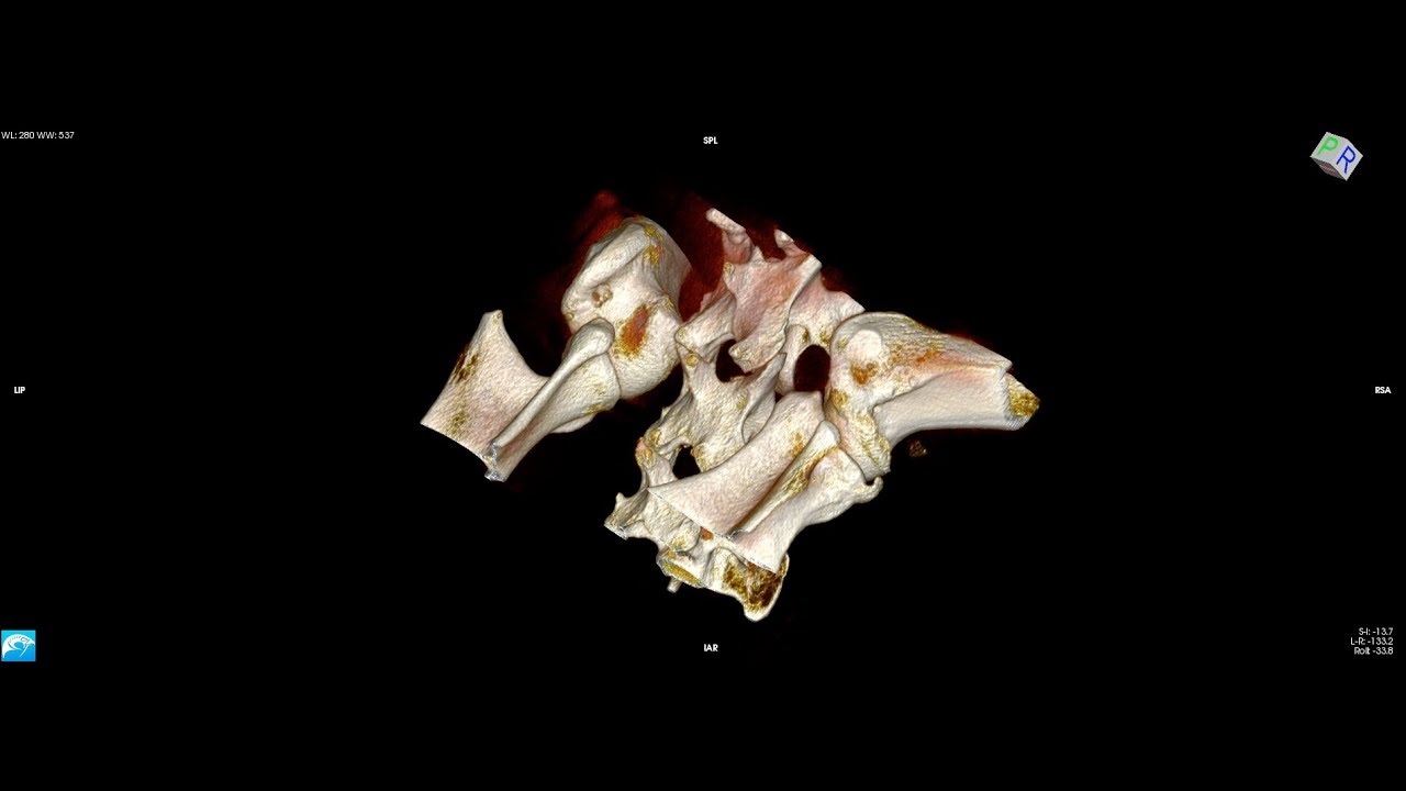 Canine Shoulders Osteochondrosis & Osteoarthrosis - YouTube