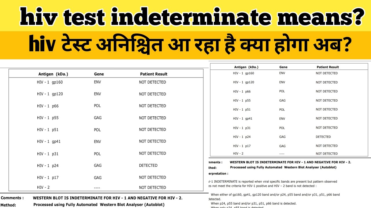 What could be the reason for the HIV test coming out inconclusive ...