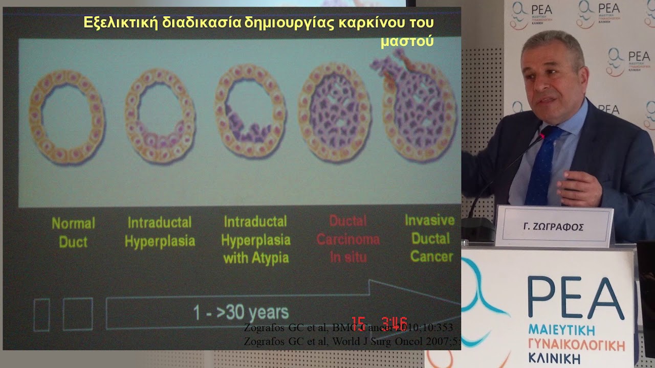 Πρώιμος καρκίνος του μαστού - Από τη διάγνωση στη θεραπεία, Γ. Ζωγράφος ...