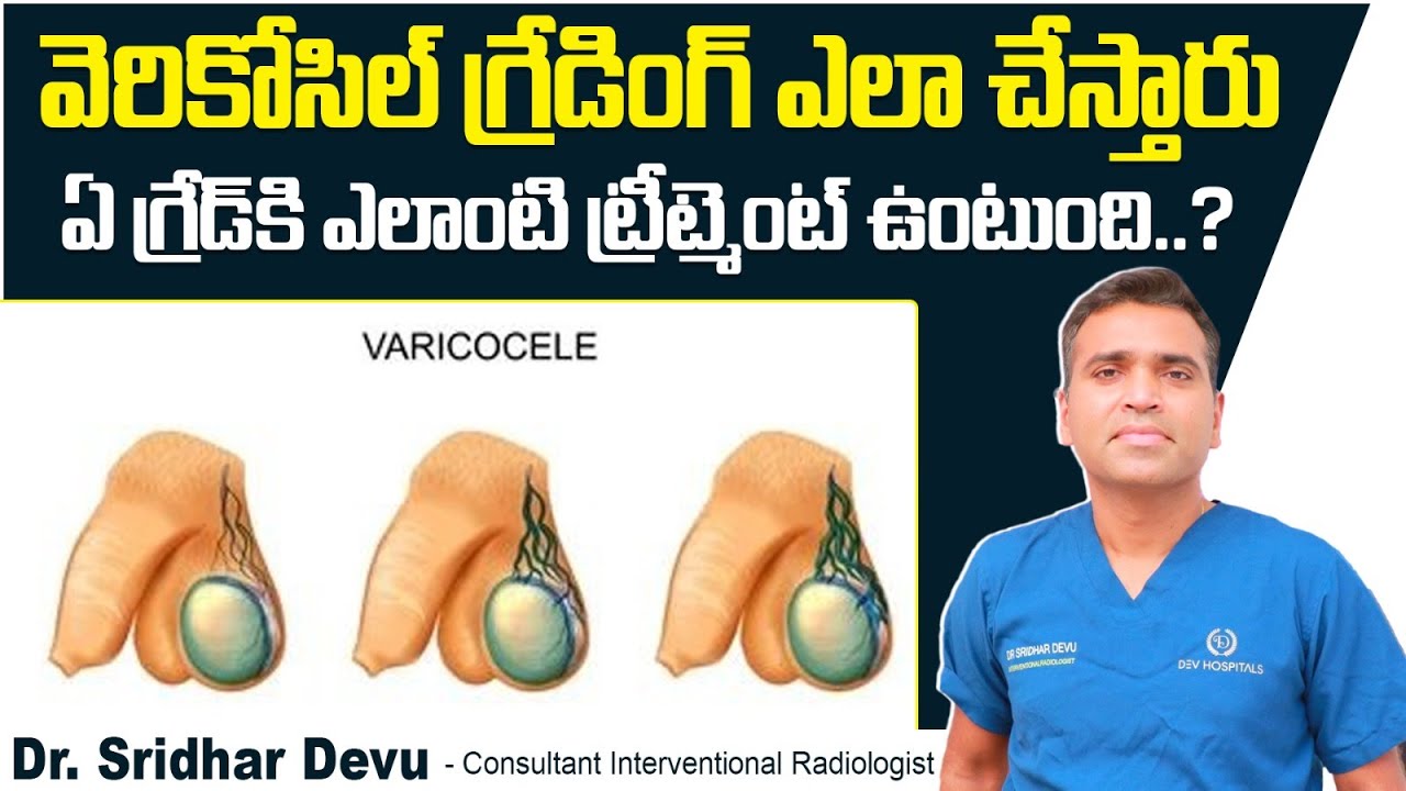 వెరికోసిల్ గ్రేడింగ్ ఎలా చేస్తారు | How to Know varicocele Grading ...