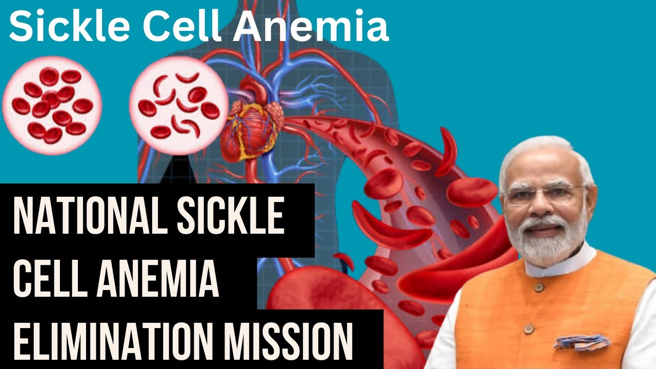 Sickle Cell Anemia | National Sickle Cell Anemia Elimination Mission ...