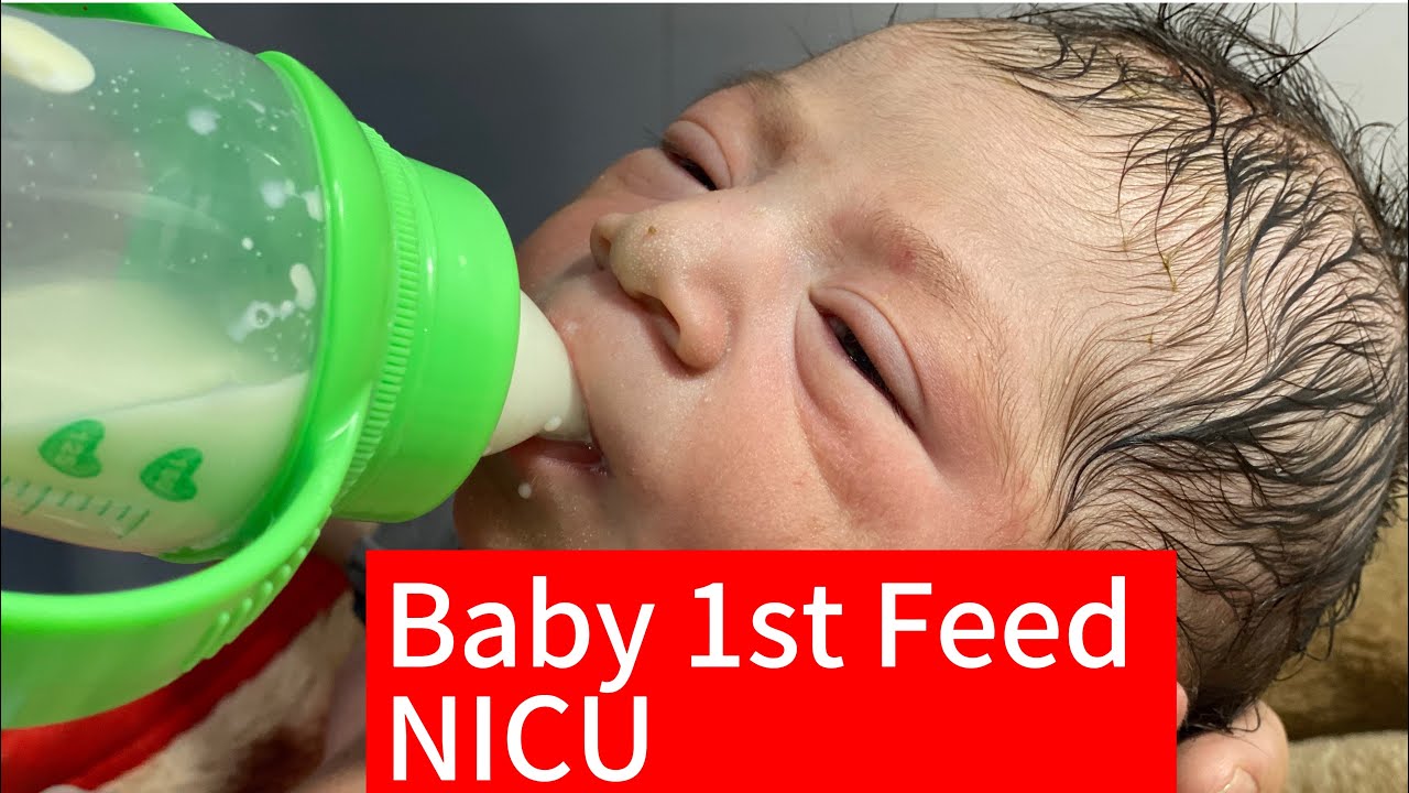 MSL Grade 3 Baby First Feed in NICU | Neonatal care - YouTube