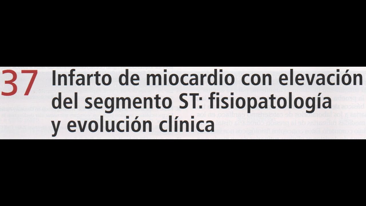 37 INFARTO DE MIOCARDIO CON ELEVACIÓN DEL SEGMENTO ST: FISIOPATOLOGÍA Y ...