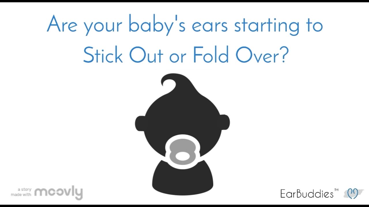 Fix Stick Out Ears at home with EarBuddies! - YouTube