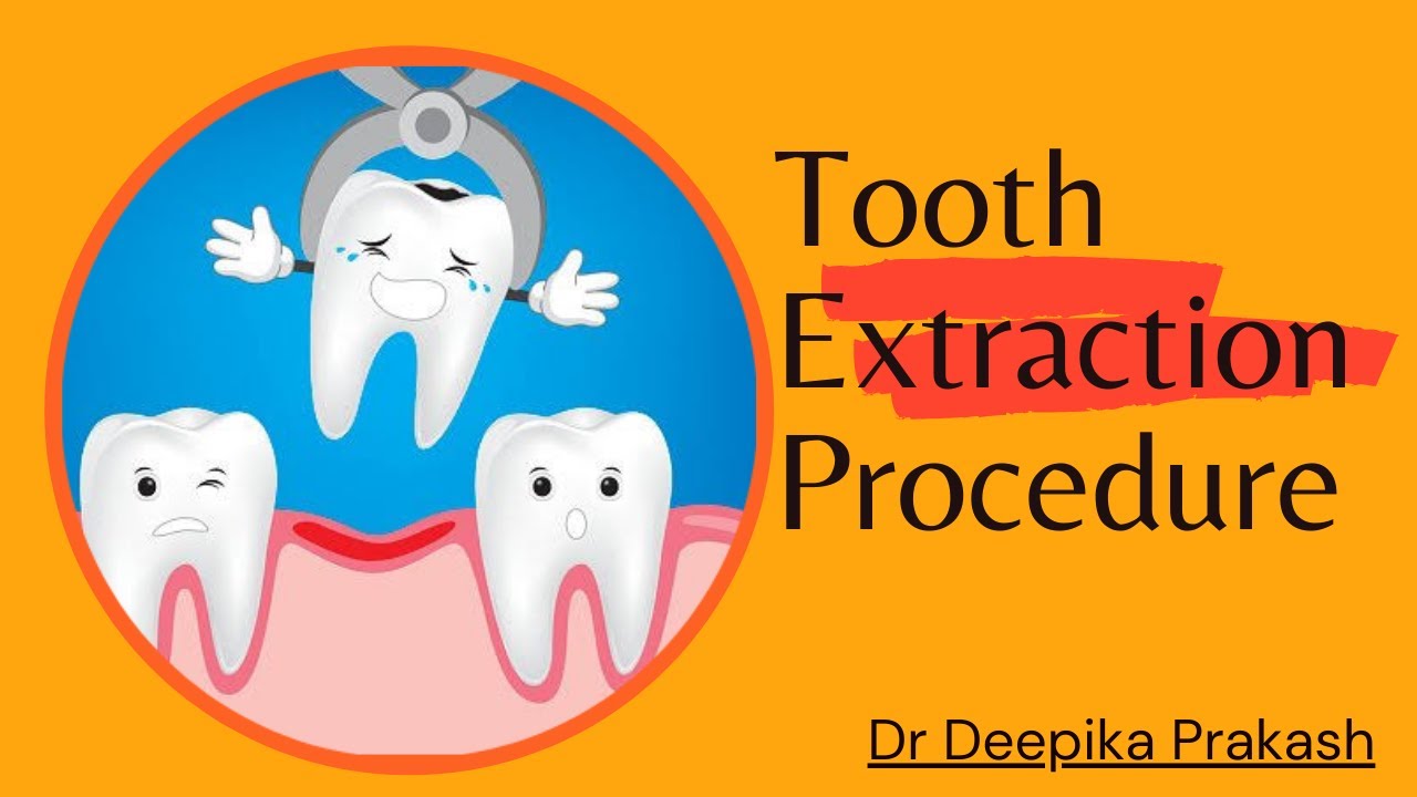 Tooth Extraction | See What Happens during Tooth Extraction | Traumatic ...