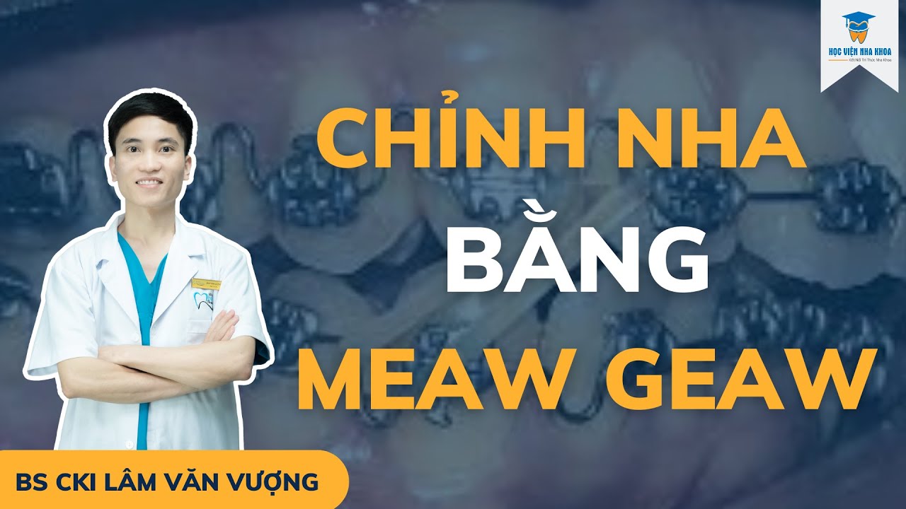 Điều Trị Chỉnh Nha Bằng Phương Pháp Meaw Geaw - YouTube