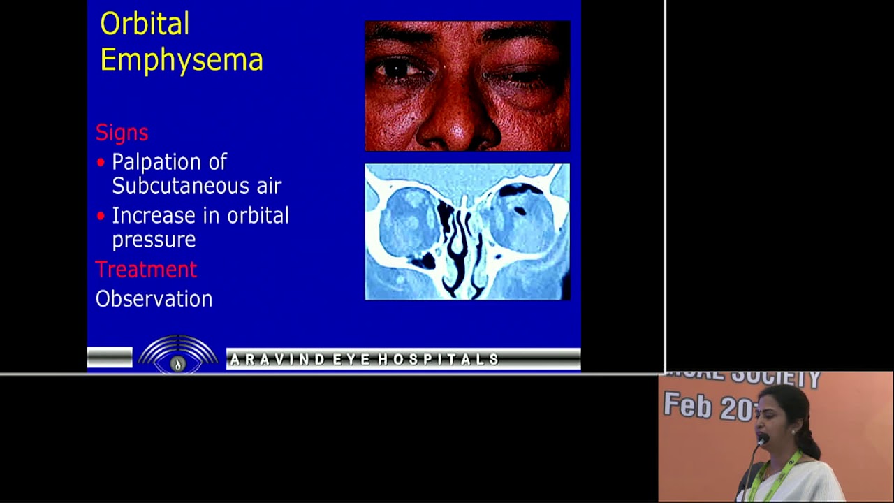 AIOC2018 - GP118 - Topic - Seven Commandments for managing Periocular ...